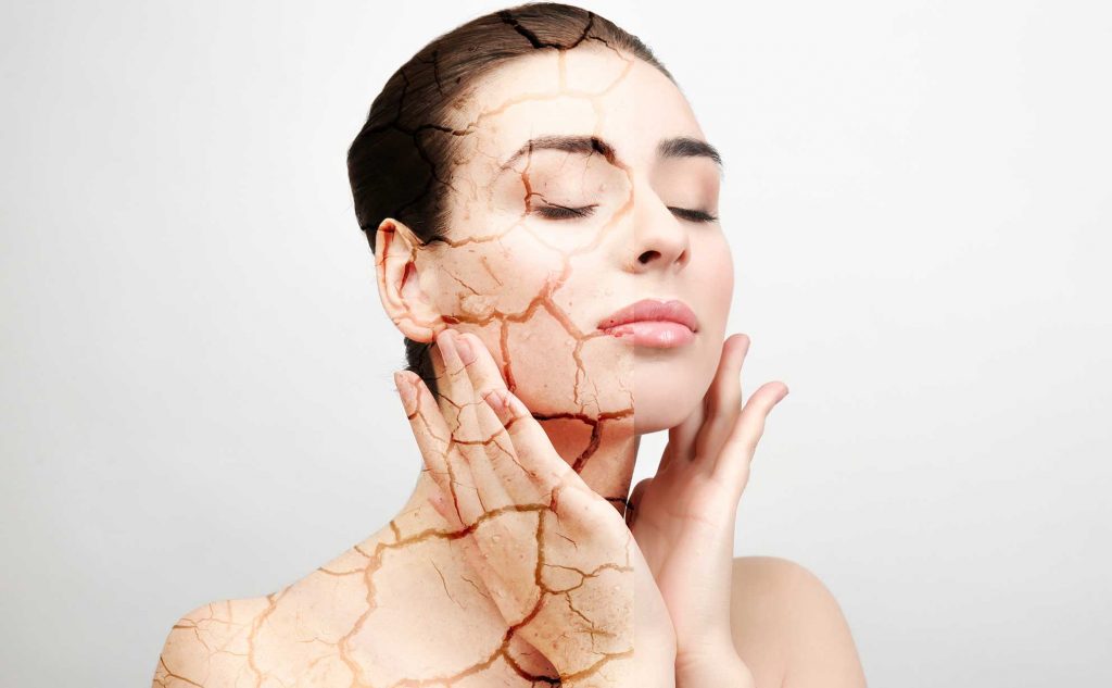 Piel Seca vs. Piel Deshidratada - ¿Como diferenciarlas?